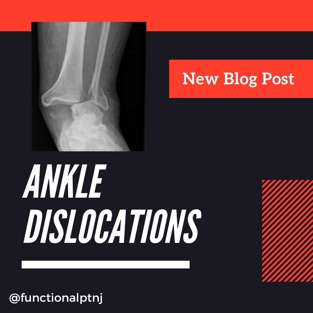 Ankle Dislocations